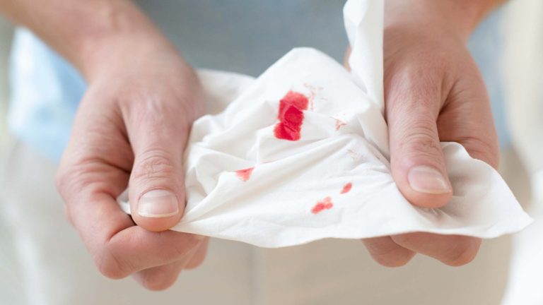 Throwing Up Blood After Drinking Alcohol: What It Means